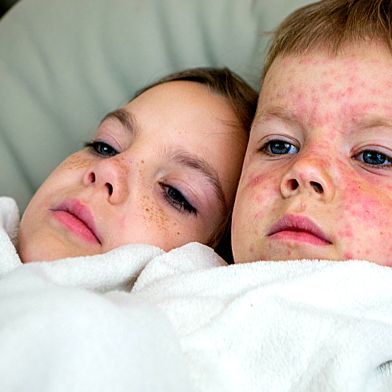 Dermatología Pediátrica – Provital – Servicio Integral de Salud
